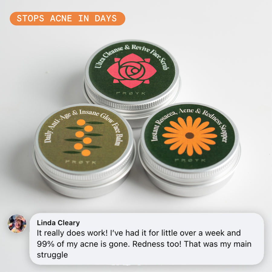 The Complete Acne System for Women | Frøya Organics
