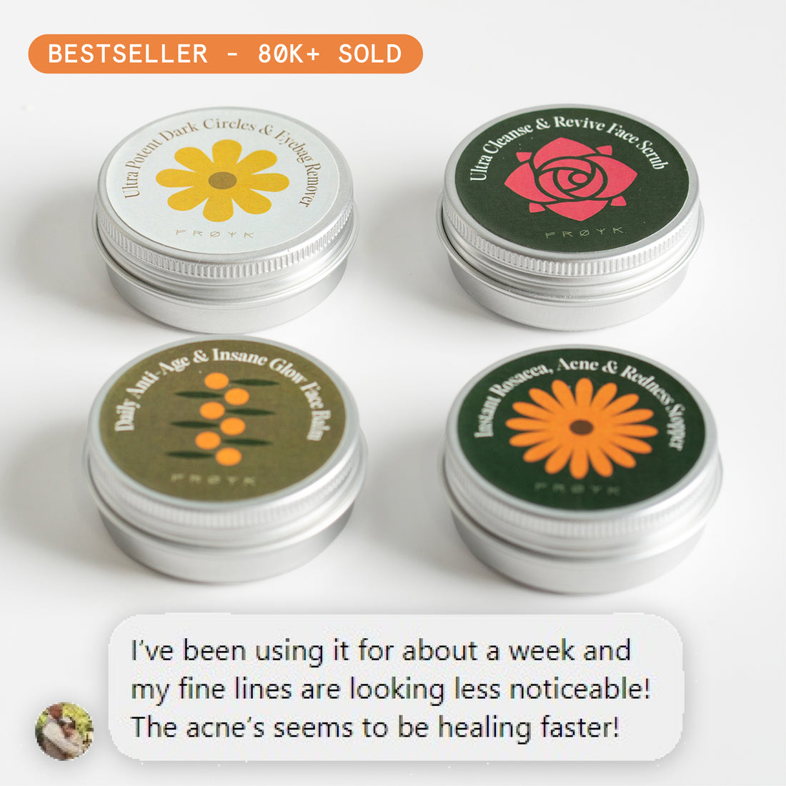 The Complete Acne System for Women | Frøya Organics